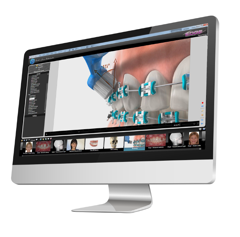 ORTHO2 BLOG | Edge Cloud: So Much More Than Just Practice Management ...